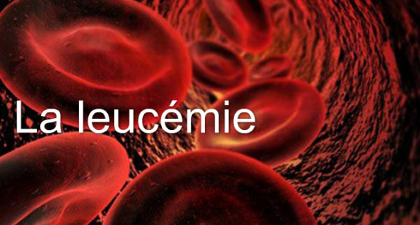 Symptômes de la Leucémie en Tunisie, infos & prix